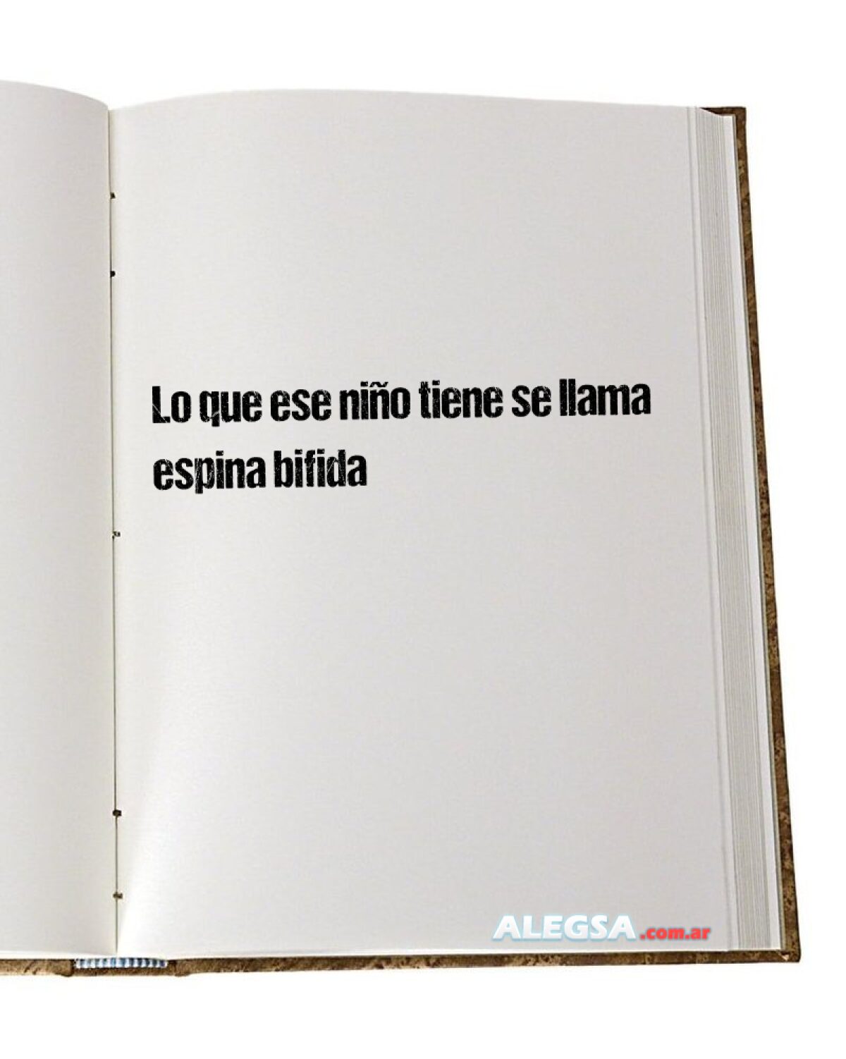 Lo que ese niño tiene se llama espina bifida
